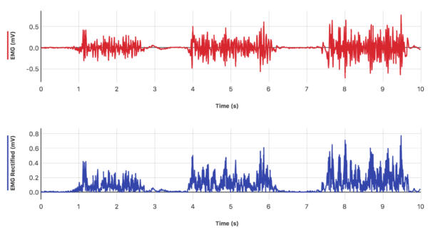 Easily Record and Analyze EMGs with Go Direct® EKG - Vernier