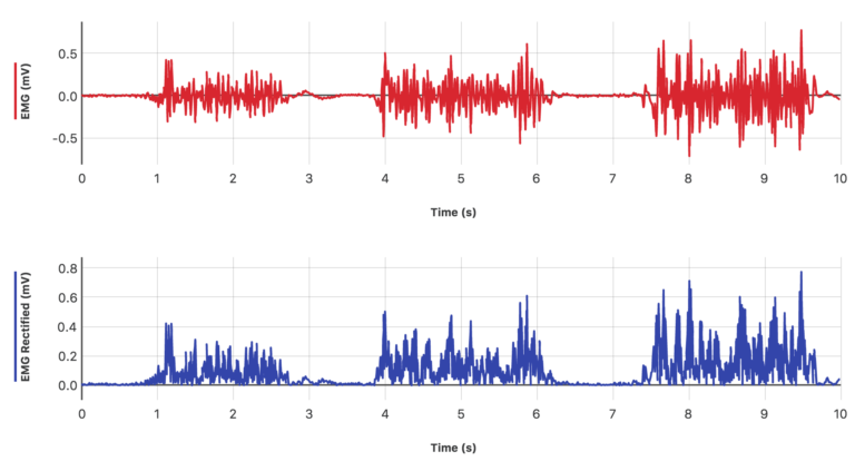 Easily Record and Analyze EMGs with Go Direct® EKG - Vernier
