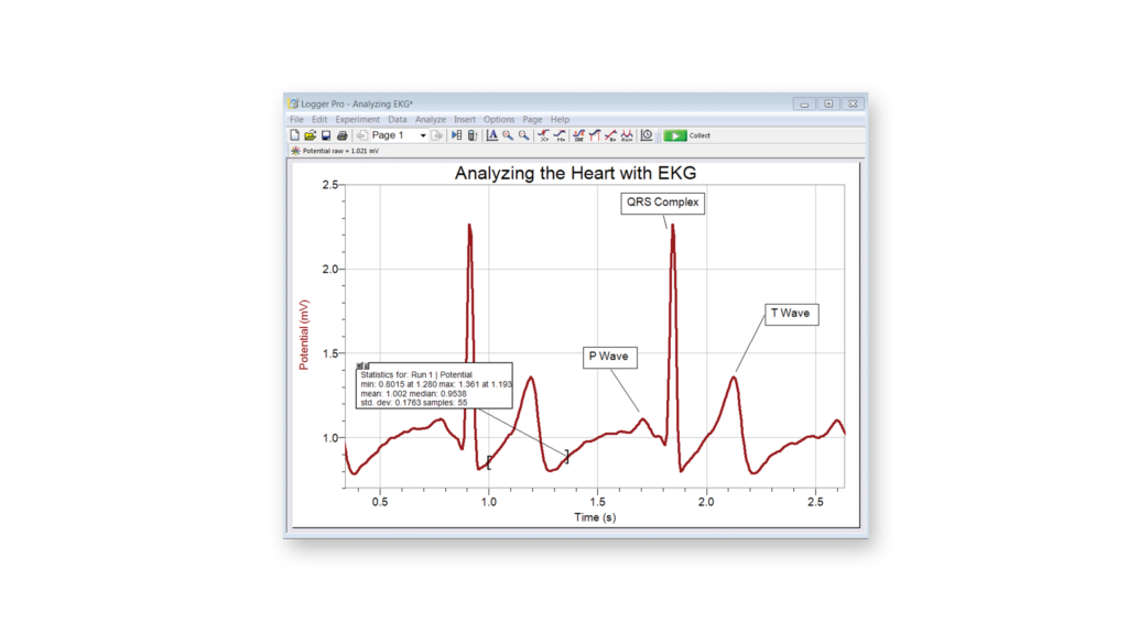 EKG Sensor - Vernier
