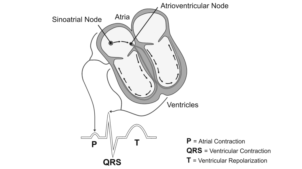 Pulse Transit Time > Experiment 4 from Human Physiology Experiments ...