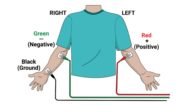 Answers to the Top Three Questions about the Go Direct® EKG Sensor - Vernier